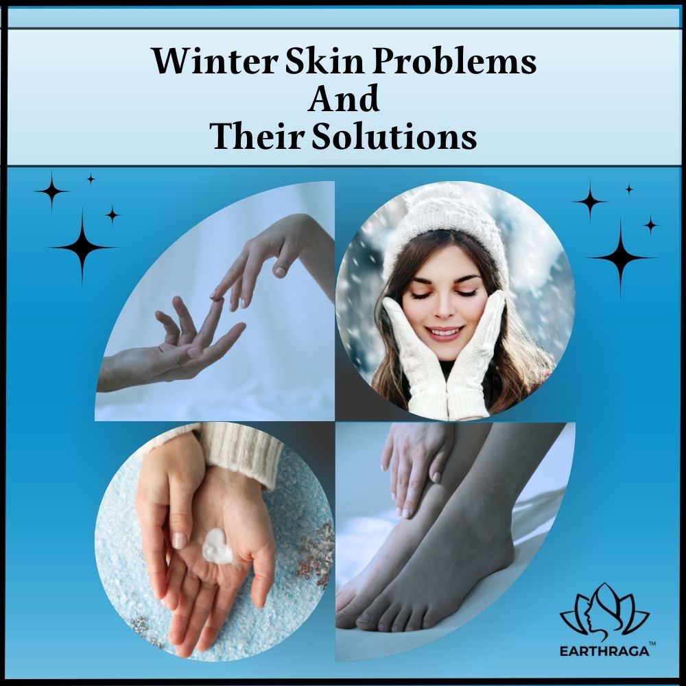 Read About All Winter Skin Problems And Their Solutions | Earthraga