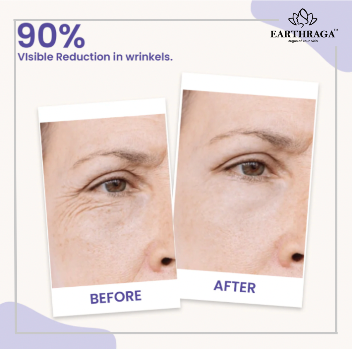 Retinol Before and After Guide - Anti-aging Done Right